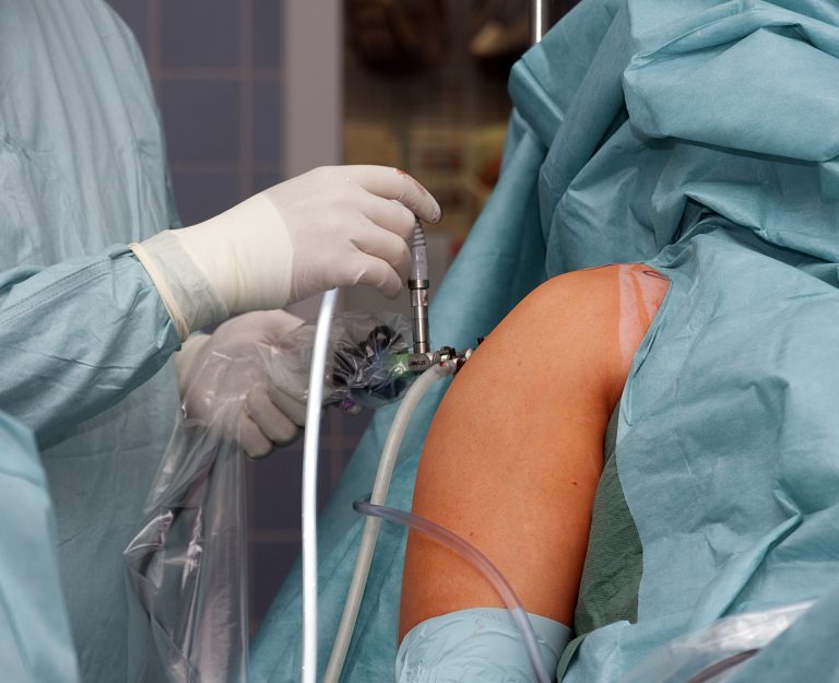 Kalkschulter | Behandlung beim Schulterspezialisten | Dr. Bahrami